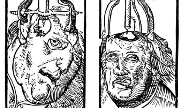 These 6 Painful Medieval Medical Procedures Will Make You Cringe - 9GAG