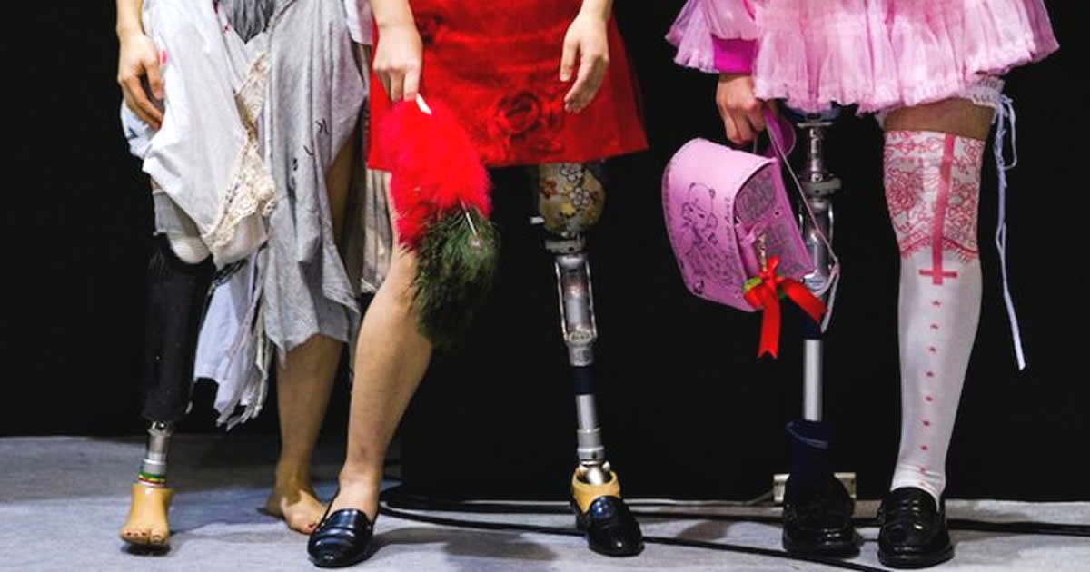 ‘Transabled’ People Are Cutting Off Their Limbs To Become Disabled - 9GAG