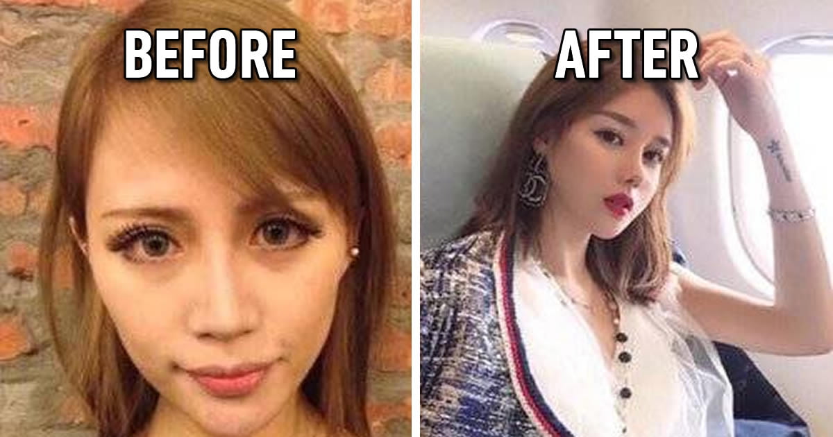 Doctor In China Exposing Social Media Celebrities Before And After