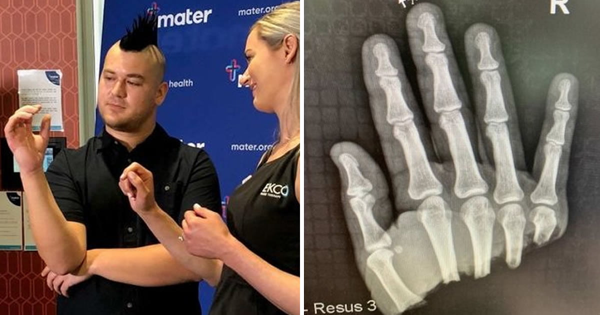 [Graphic] Man Whose Hand Was Severed By Meat Slicer Wriggles Fingers ...
