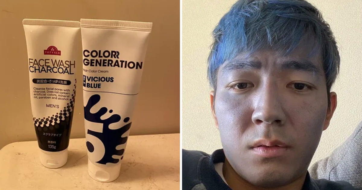 Guy's Face Turns Blue After Mistaking Color Treatment For Face Wash - 9GAG