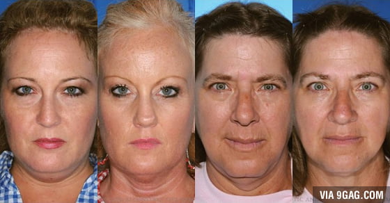 Twins Study Shows Smoking Ages Your Face Faster - 9GAG