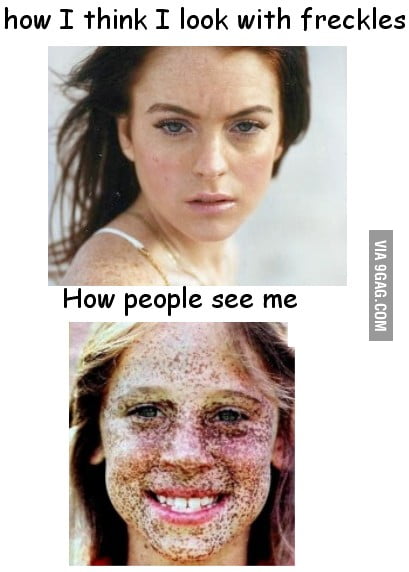 Freckles - 9GAG