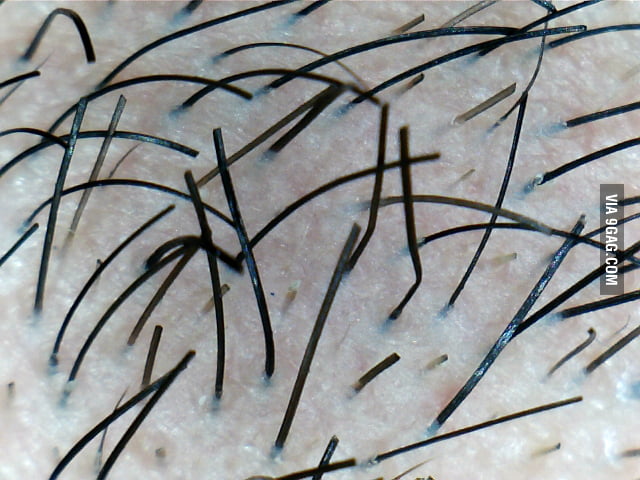 My beard as seen by a microscope - 9GAG