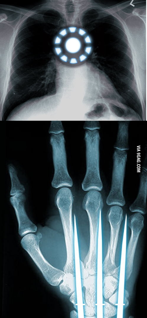 X-RAYS - 9GAG