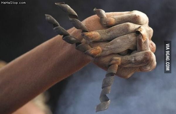 Gross finger nails - 9GAG