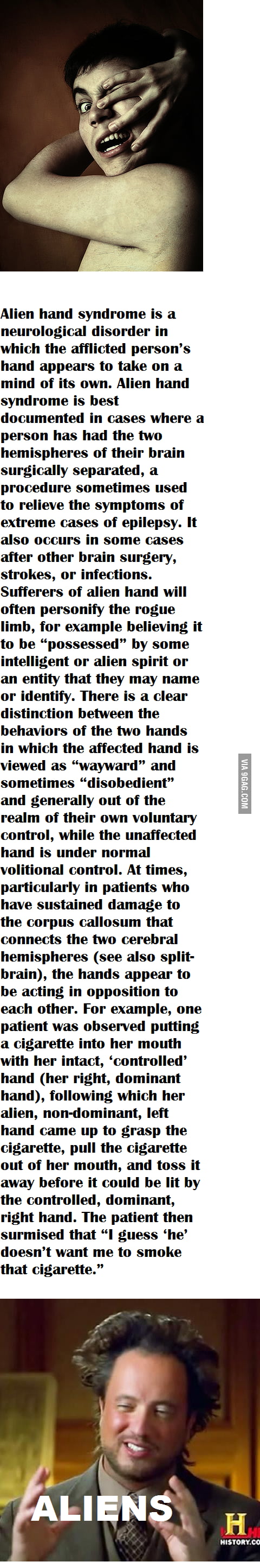 Alien hand syndrome - 9GAG