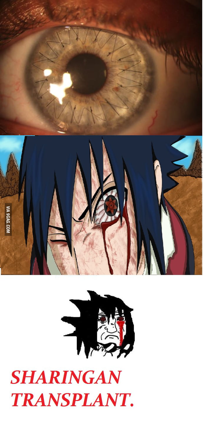 Mother of Cornea Sharingan Transplant - 9GAG