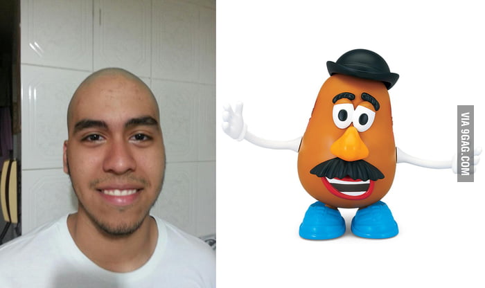 My friend looks like Mr. Potato Head now that he is bald - 9GAG