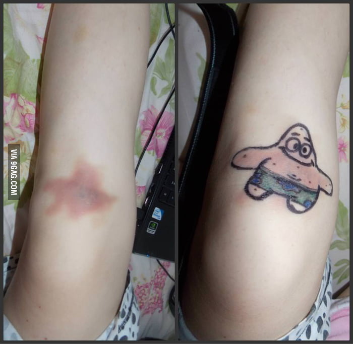 My friend had a bruise.. I saw a patrick. - 9GAG