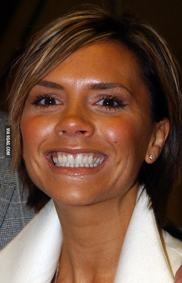 And that's why Victoria Beckham never smiles - 9GAG