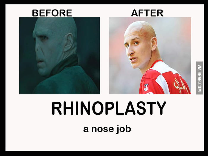 Voldemort Nose Job