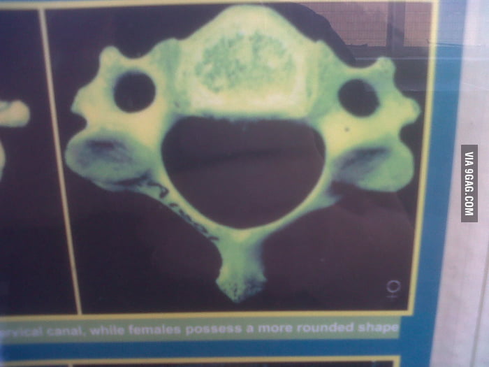 Happy vertebra is happy... - 9GAG