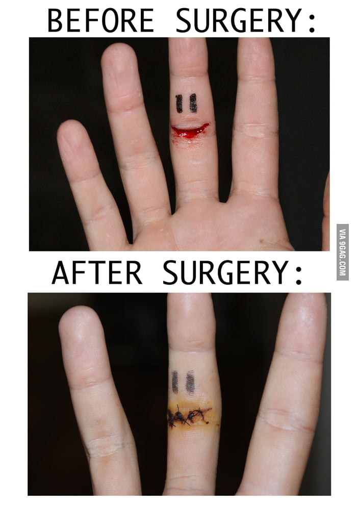 Happy/Sad wound - 9GAG