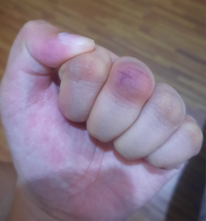 There's this weird part of my body whenever I get sick. This middle ...