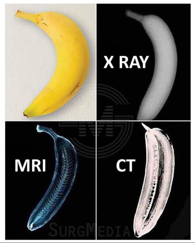Different Types Of Medical Scans 9GAG different-types-of-medical-scans-9gag