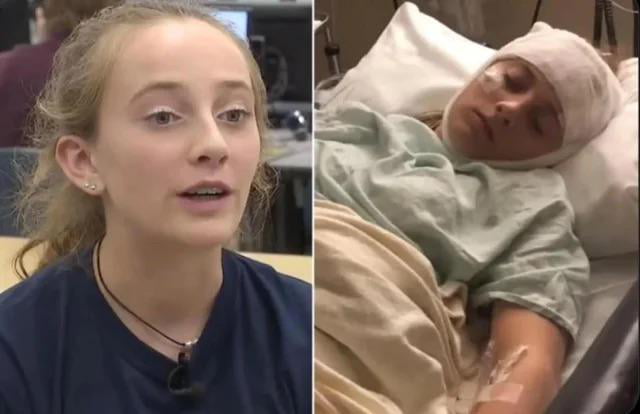 In June 2019, Illinois teen Riley Horner suffered a head injury from a ...