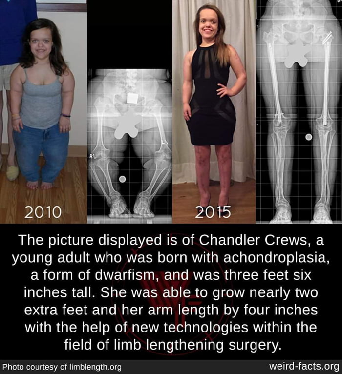 This is incredible! - 9GAG