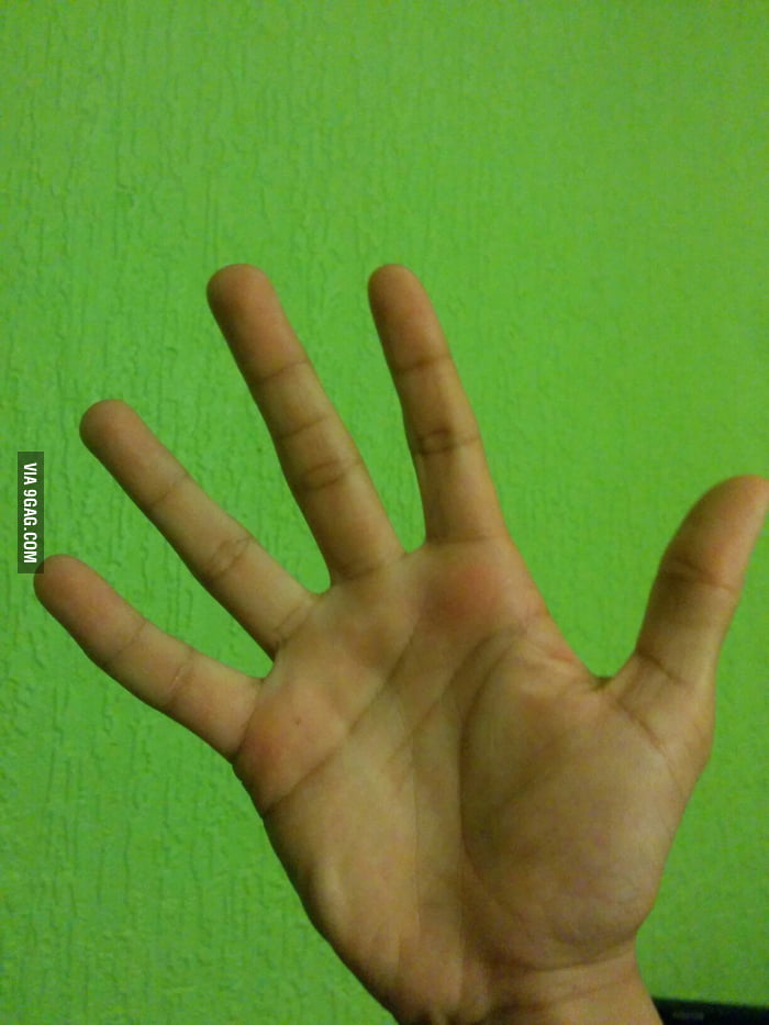 To the guy who had 4 partitions on his middle finger...I guess I wasn't ...