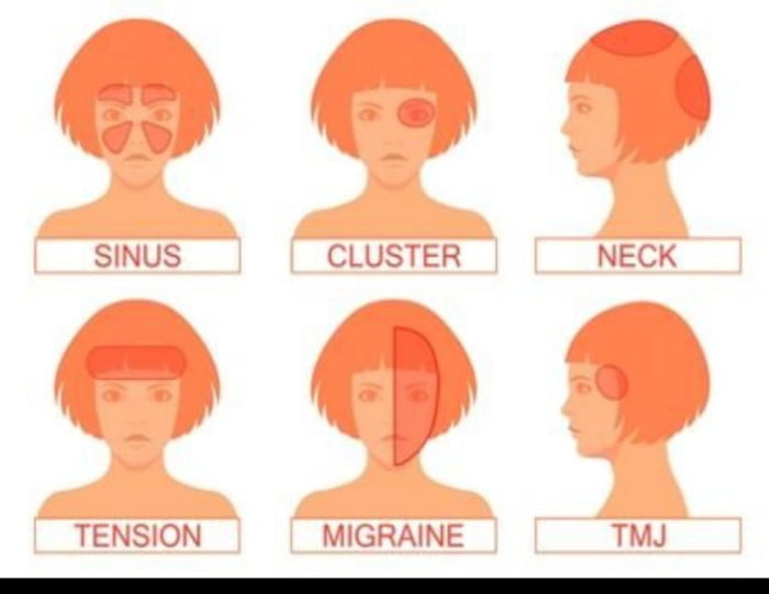 Headache guide - 9GAG