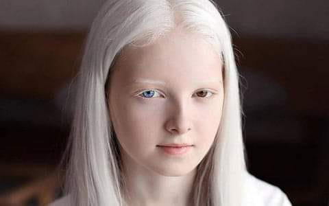 A super rare case - Albinism and Heterochromia. Yes, she is real - 9GAG