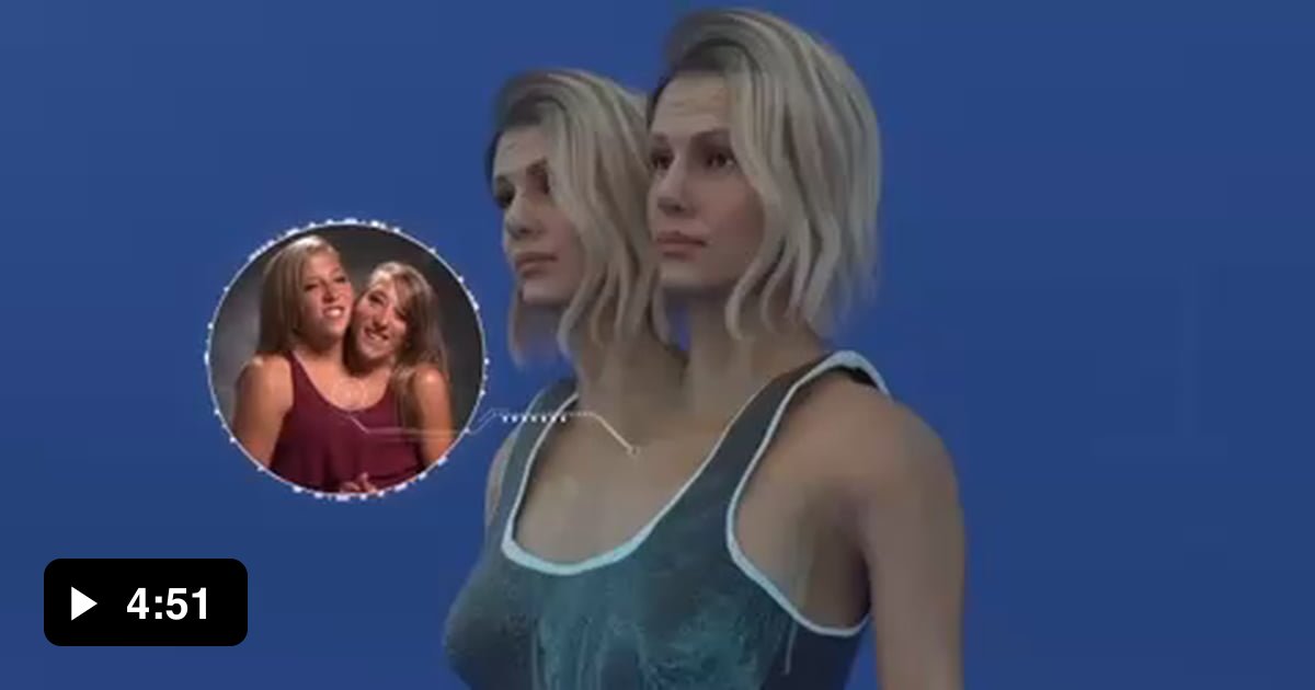 The Fascinating Anatomy Of Conjoined Sisters - 9GAG