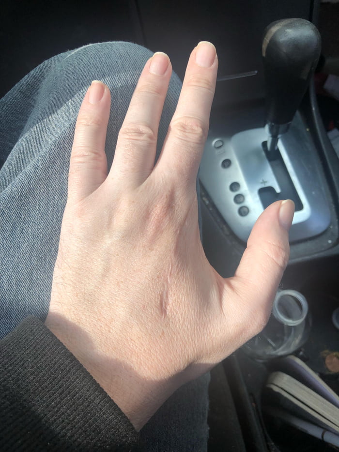 “Shot” hand! - 9GAG