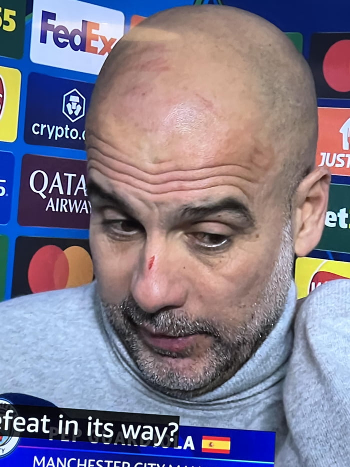 Pep emerges from the dressing room with a few scrapes - 9GAG