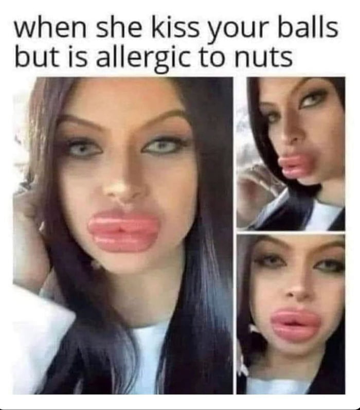 Allergic to nuts. - 9GAG