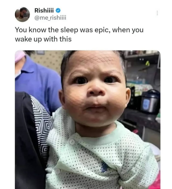 Woke up with a new skin pattern - 9GAG