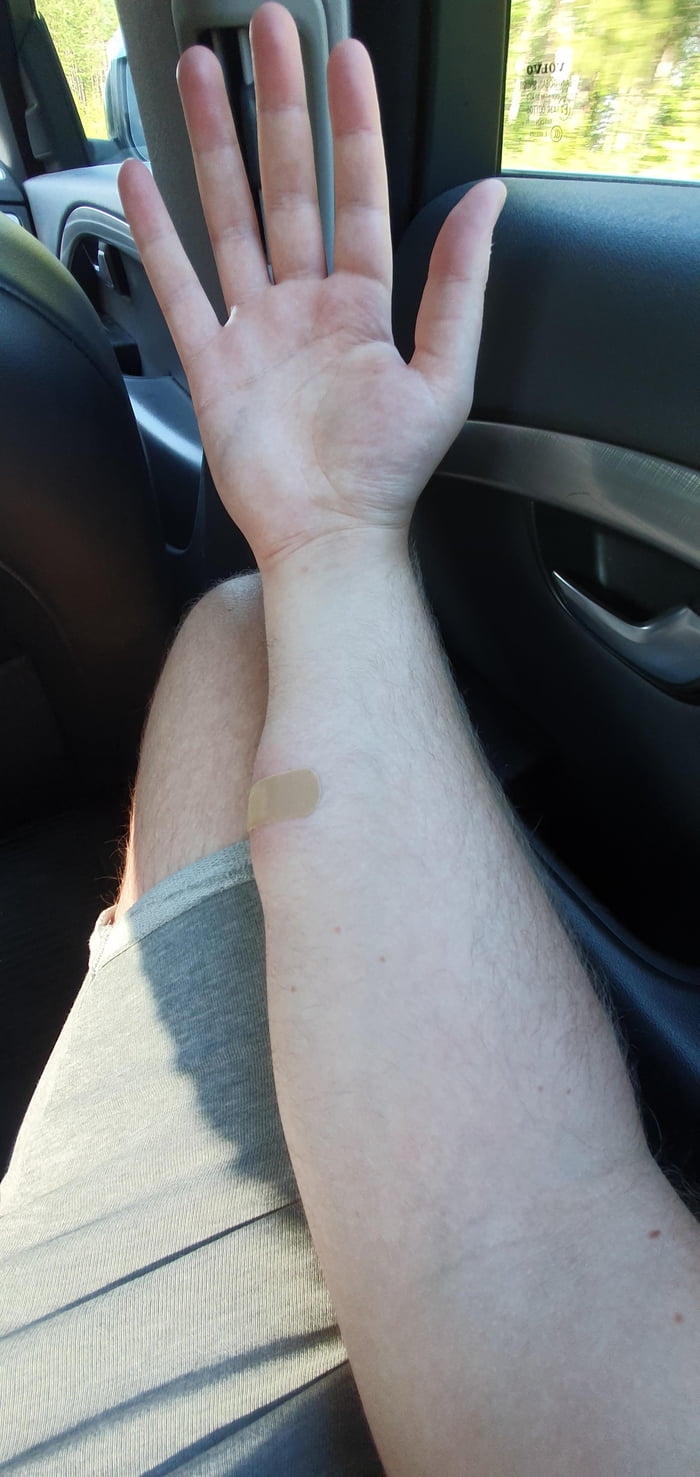 Unknown insect bite - 9GAG