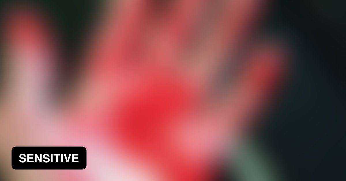 My stress ball just exploded - 9GAG