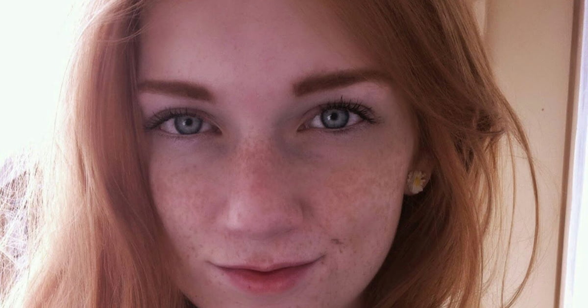 Freckles and Dimples - 9GAG