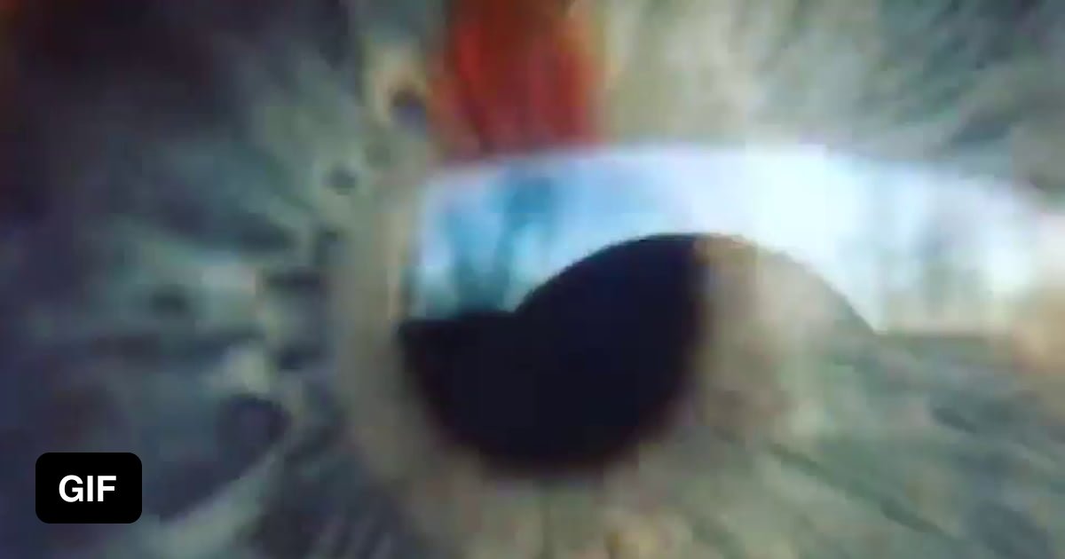 When you move your eye, the fluid inside doesn't move instantly. This ...