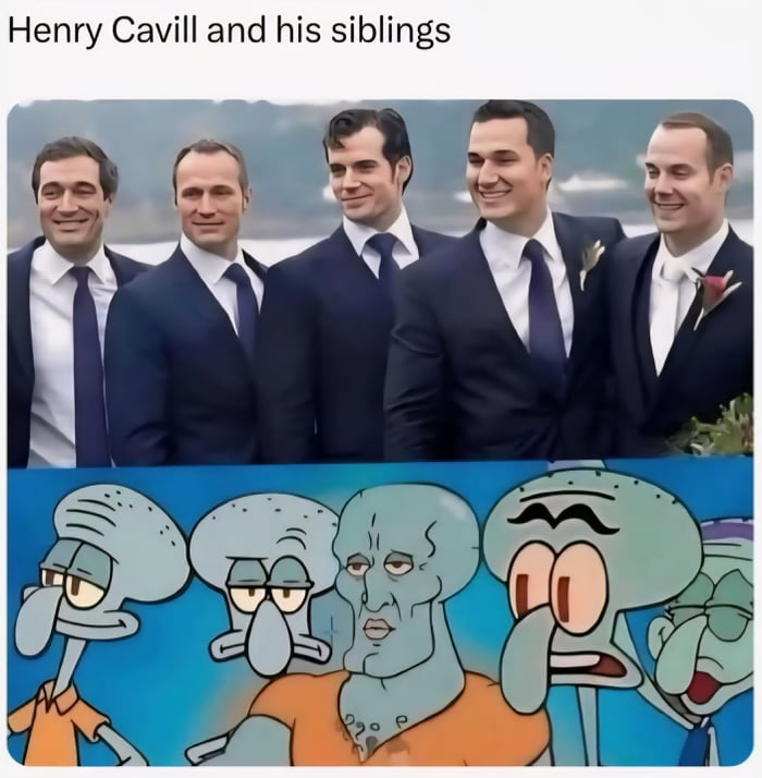 Bro won the gene lottery - 9GAG