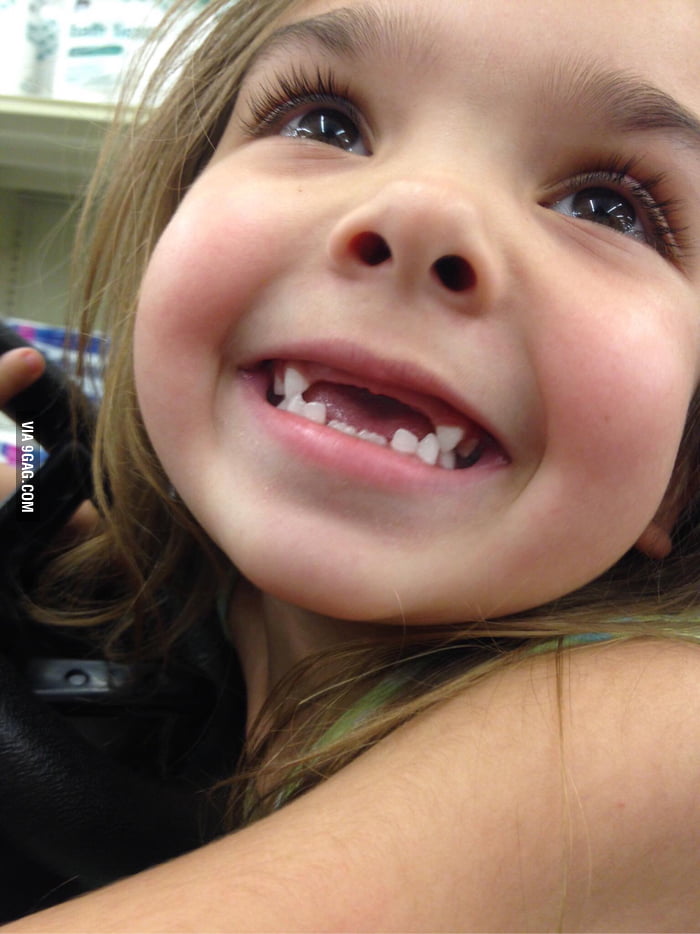 My 5 year old lost her 4 front teeth in an accident & now has 2 sharp, mini fangs. - 9GAG