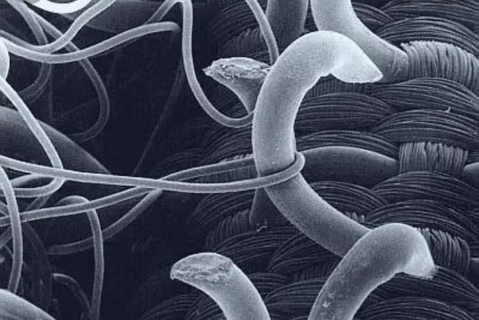 This is what Velcro looks like when under a microscope. This explains ...