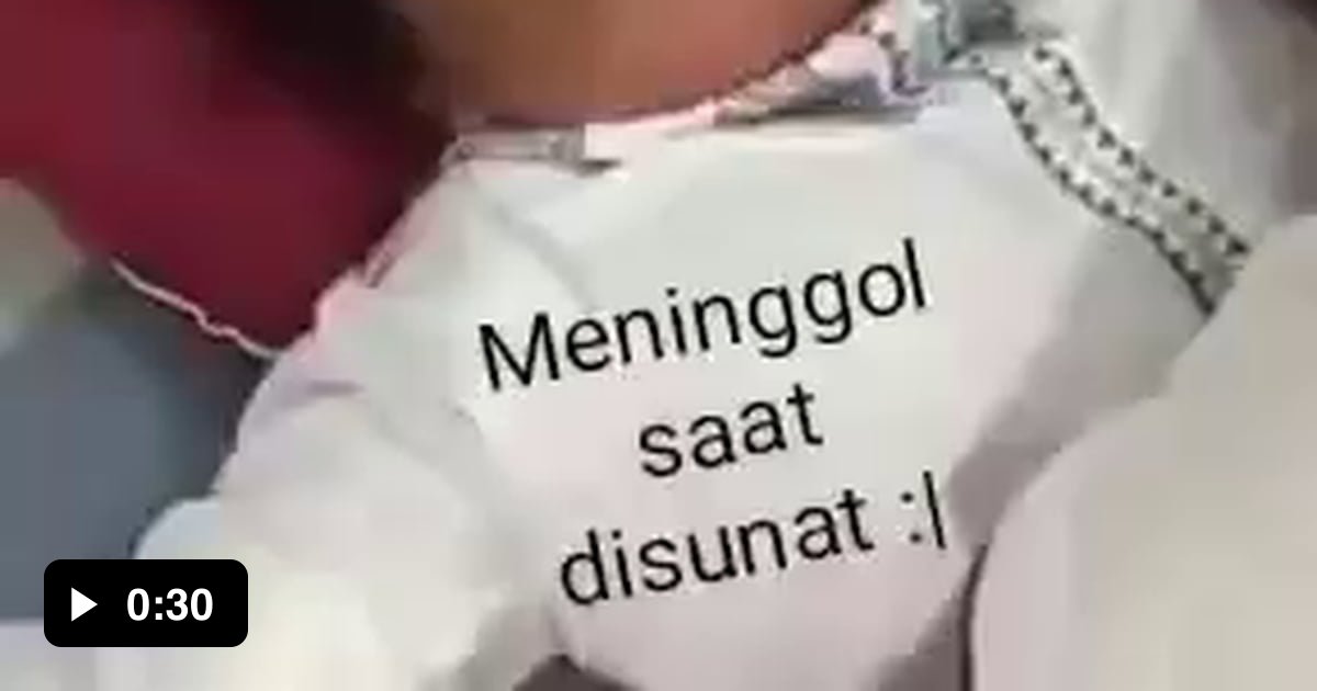 Emang kalau salah potong gitu bisa mati? - 9GAG