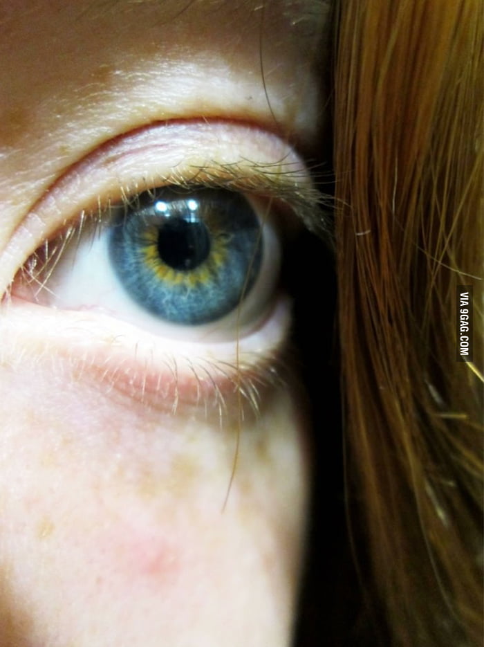 Natural Sunflower Eyes - 9GAG