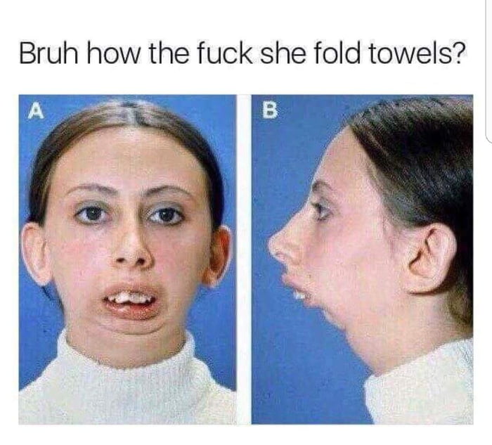 When you have no chin,yet still manage to have a double chin... - 9GAG