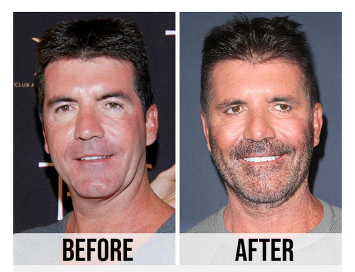 Simon Cowell after years of Botox. - 9GAG