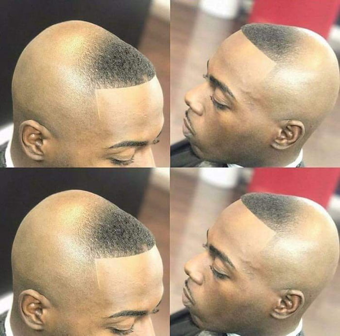 Just gimme the reverse bald spot. Say no more fam... - 9GAG
