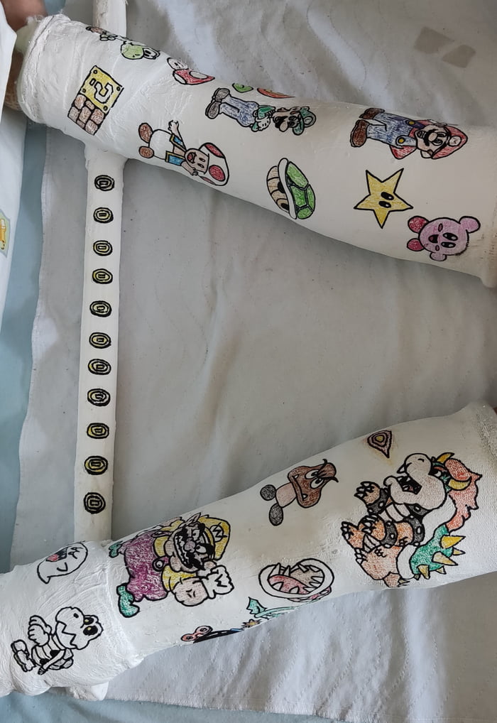 My son (6) had surgery, and my wife and I have pimped his plaster cast ...
