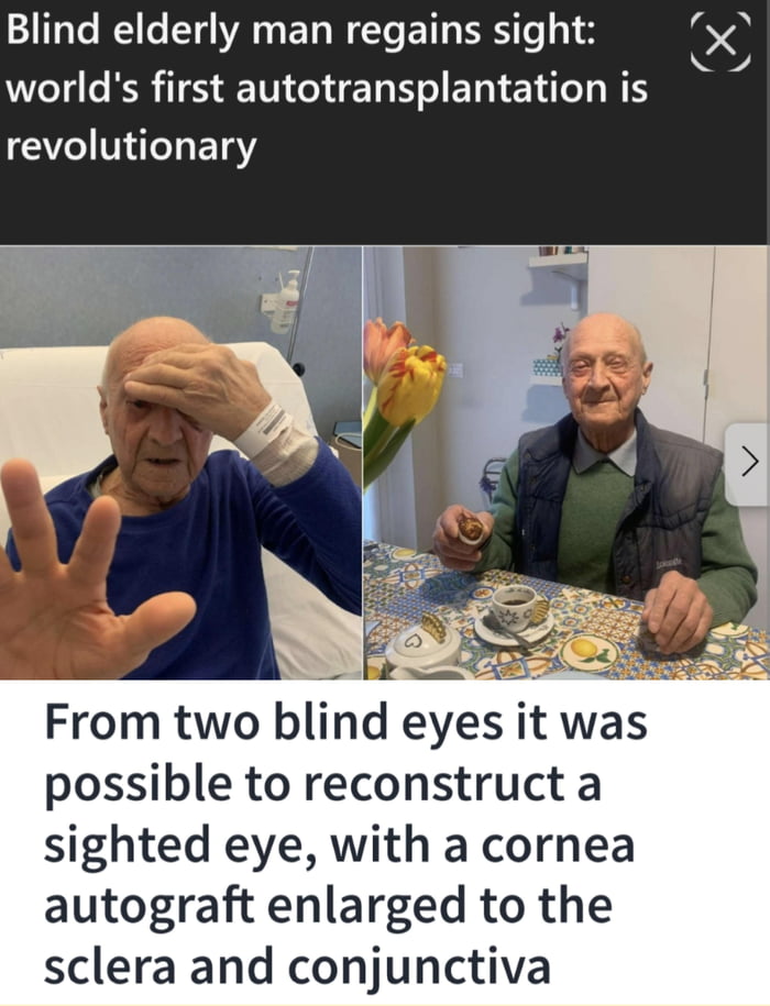 Revolutionary world's first autotransplantation: Blind elderly man regains sight - 9GAG