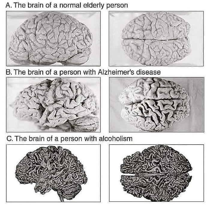 Keep your brain moist - 9GAG