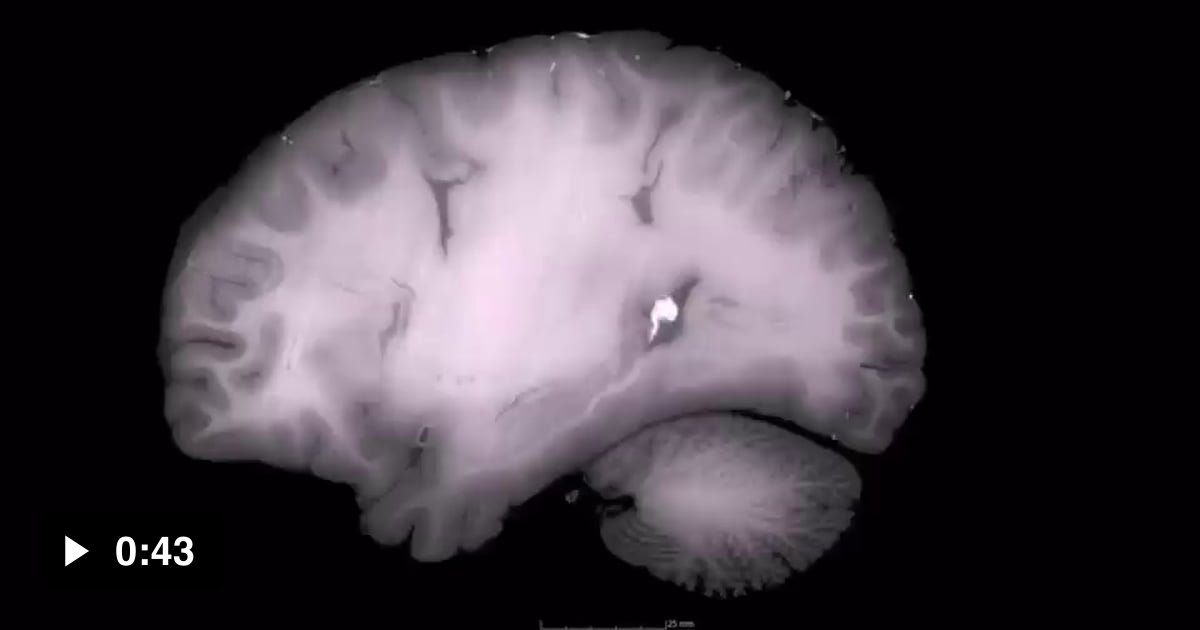 Amazing New Brain Imaging Technology using HiP-CT - 9GAG