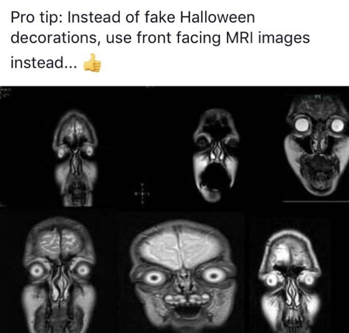 Never know front facing MRI are that scary - 9GAG