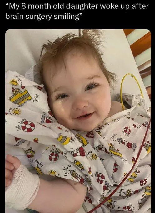 An 8 months old baby woke up after a brain surgery smiling - 9GAG