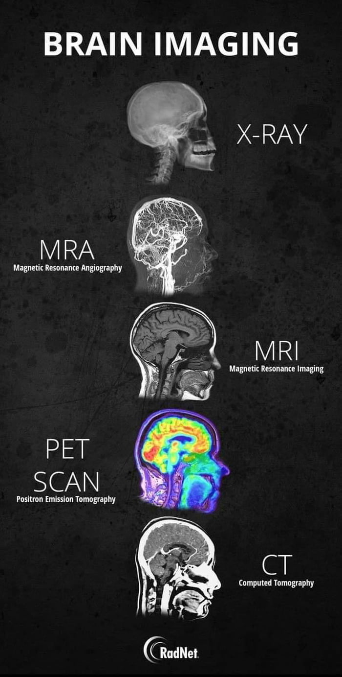 Different types of brain imaging - 9GAG