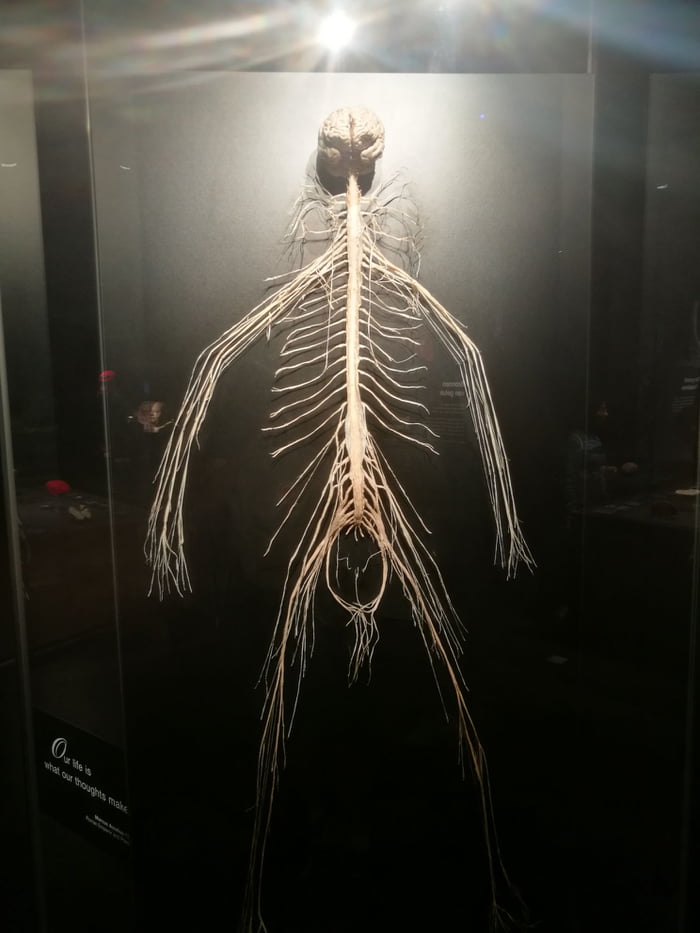 A Real Human Nervous System Displayed In Amsterdam 9GAG